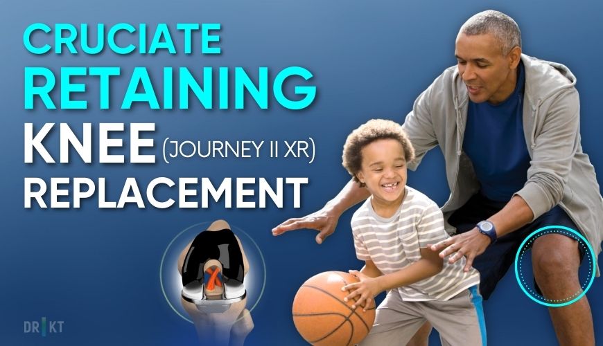 Best Knee Replacement Implant: Journey II XR Protecting the Cruciate ...