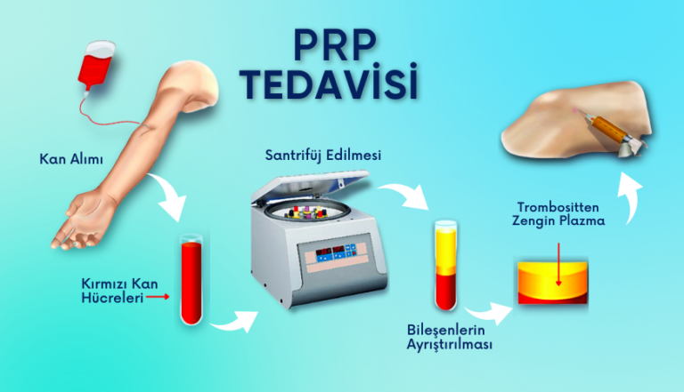 Diz İğnesi: Ameliyatsız Diz Sıvı Kaybı Tedavisi | Kayhan Turan ...